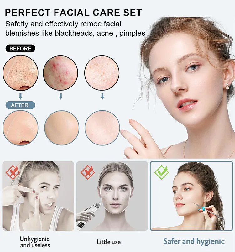 Professional Zit Whitehead Popper Pimple Extractor Tools Set 7pcs ...