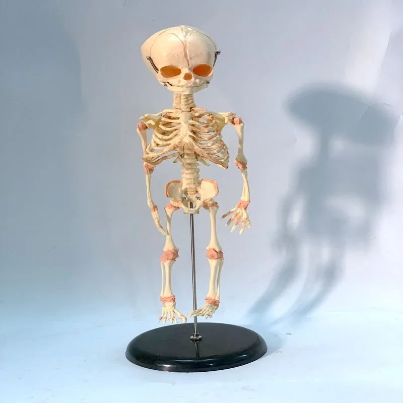 KyrenMed Infant Skeleton Model Fetus Skull Model Life Size 15.7 Inch ...