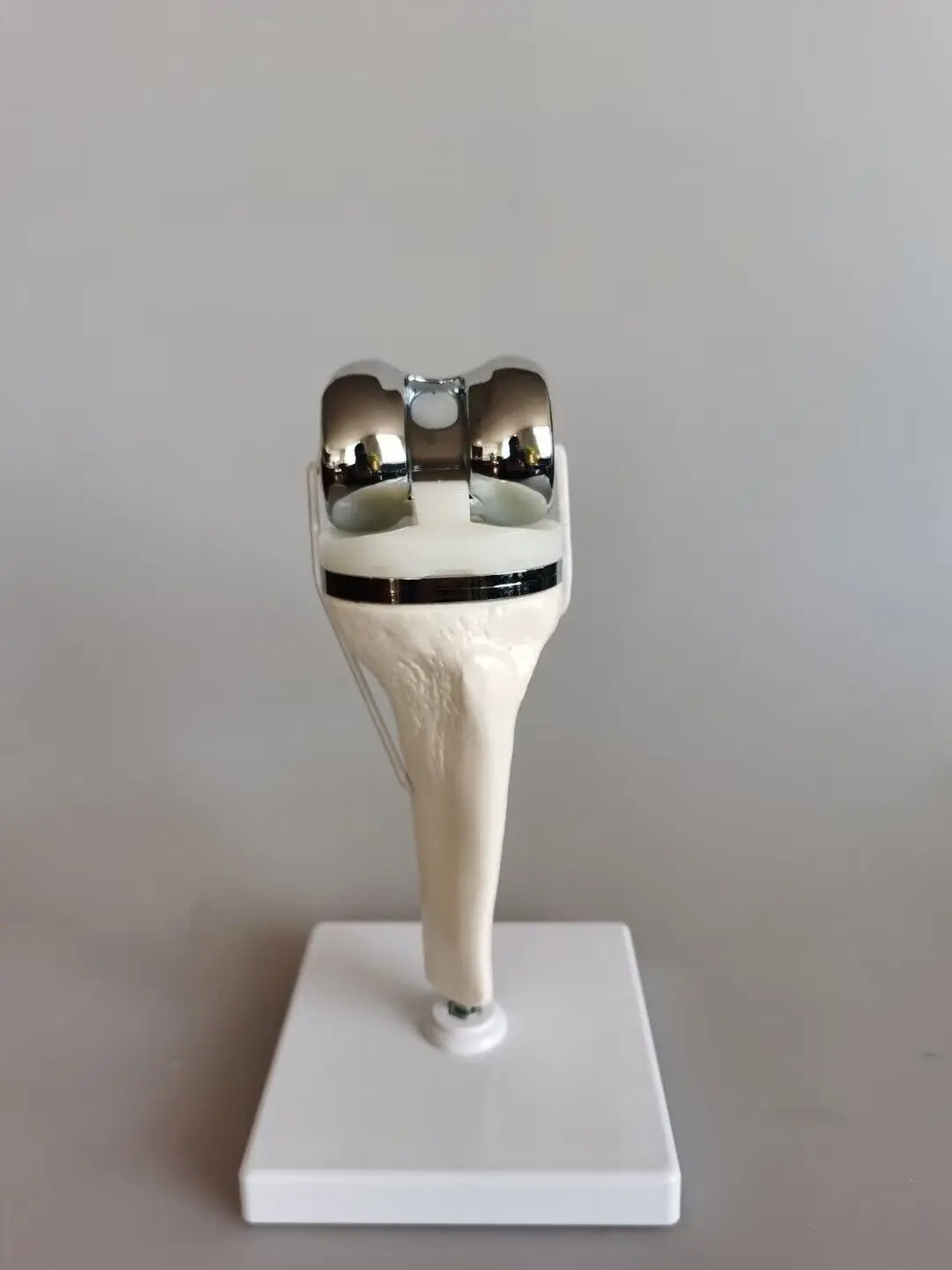 Kyrenmed Transparent Knee Replacement Model - Advanced ABS
