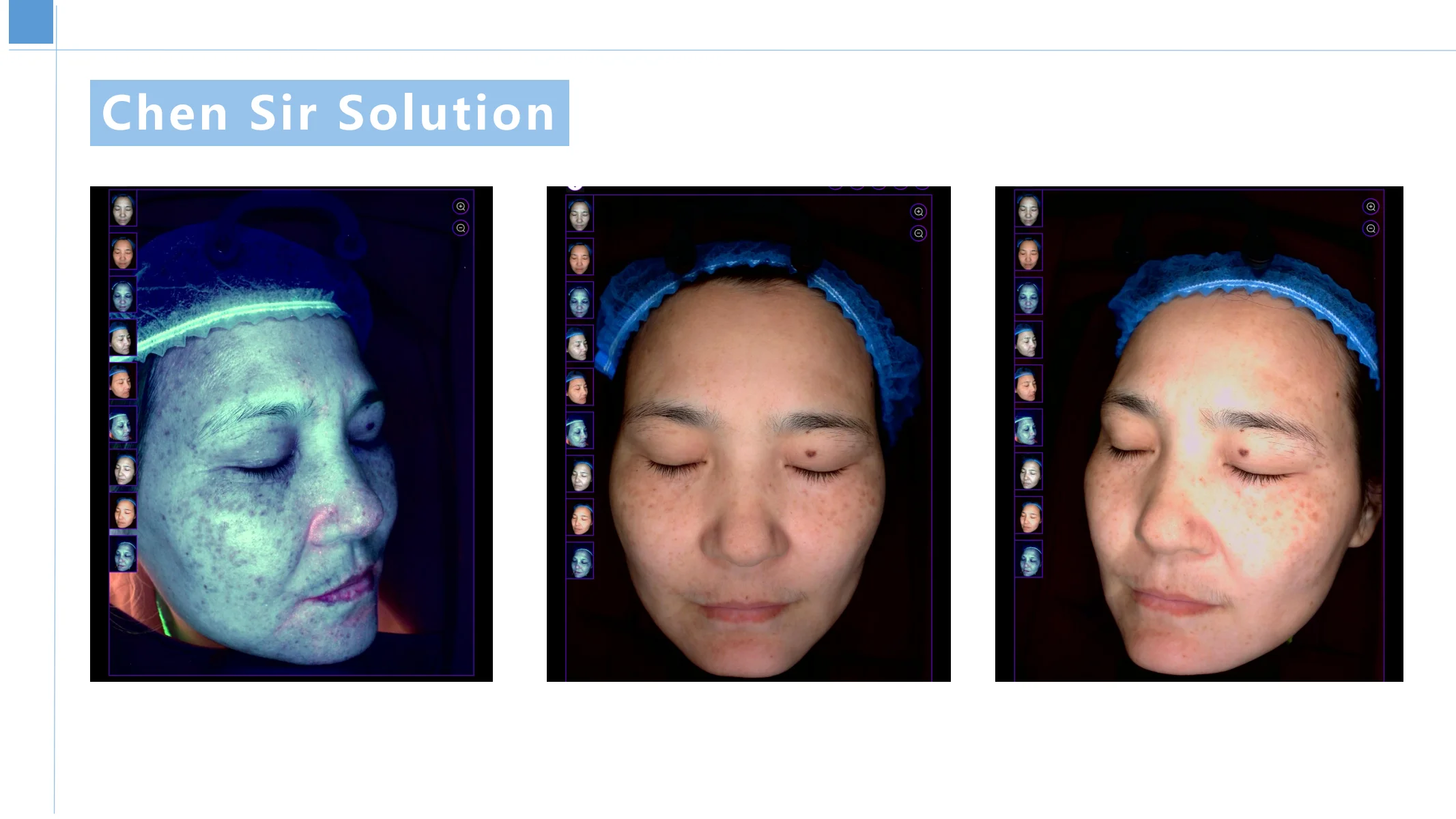 Aisia AI Smart 3D Skin Detector - Advanced Face Analysis