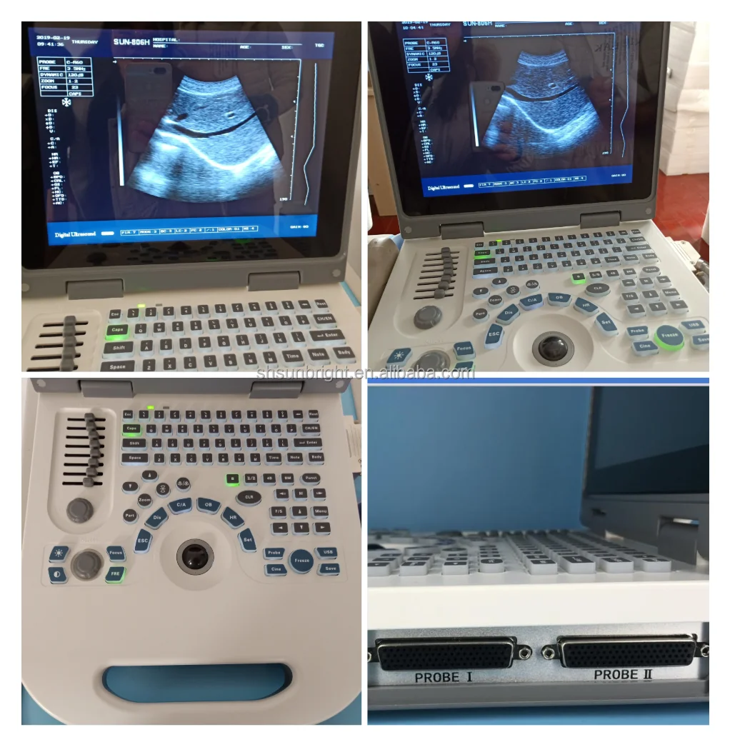 SUN-806G Ultrasound Machine - Portable Diagnostic Scanner