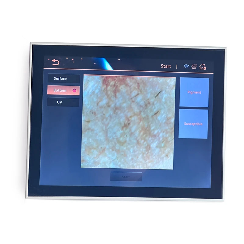 AI High Resolution Touch Screen 3D Image Beauty Salon Use Visia Skin ...