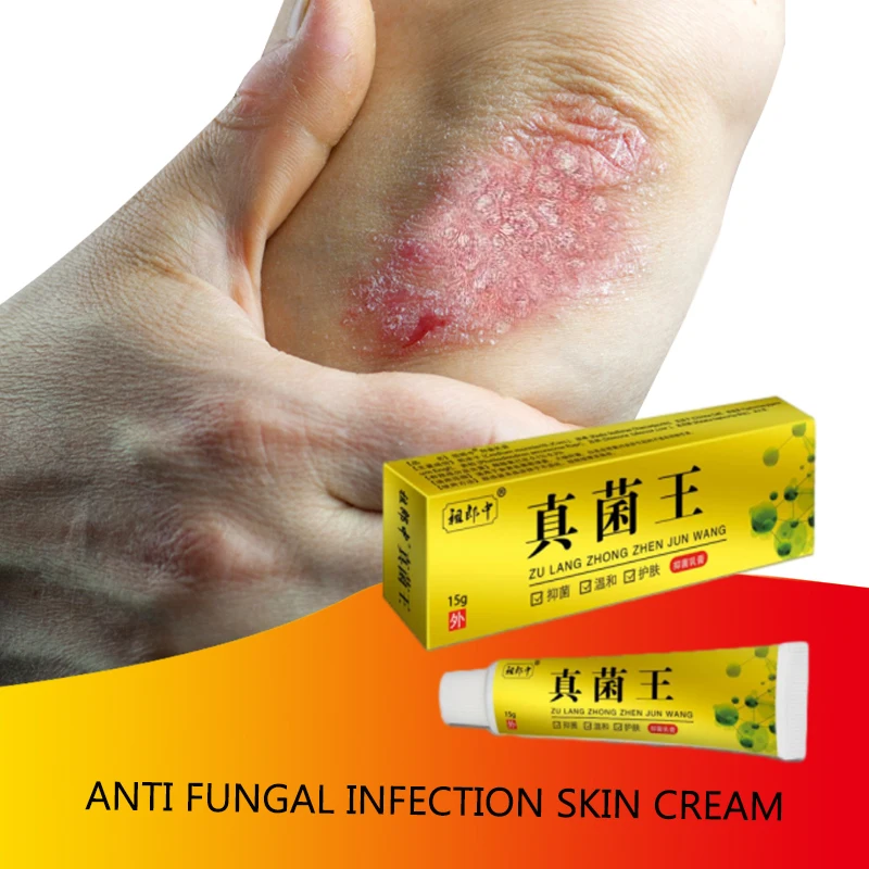 15g Anti-Itch Dermatitis Inflammation Rashes Cream Eczema Ointment ...