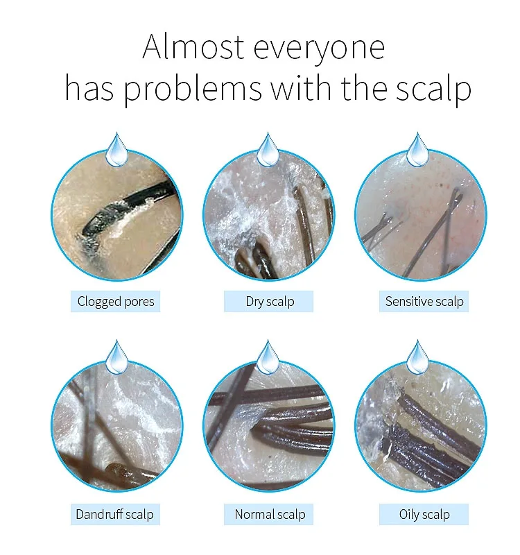 Wireless Scalp Scanner Camera 500X HD Hair Follicle Analyzer