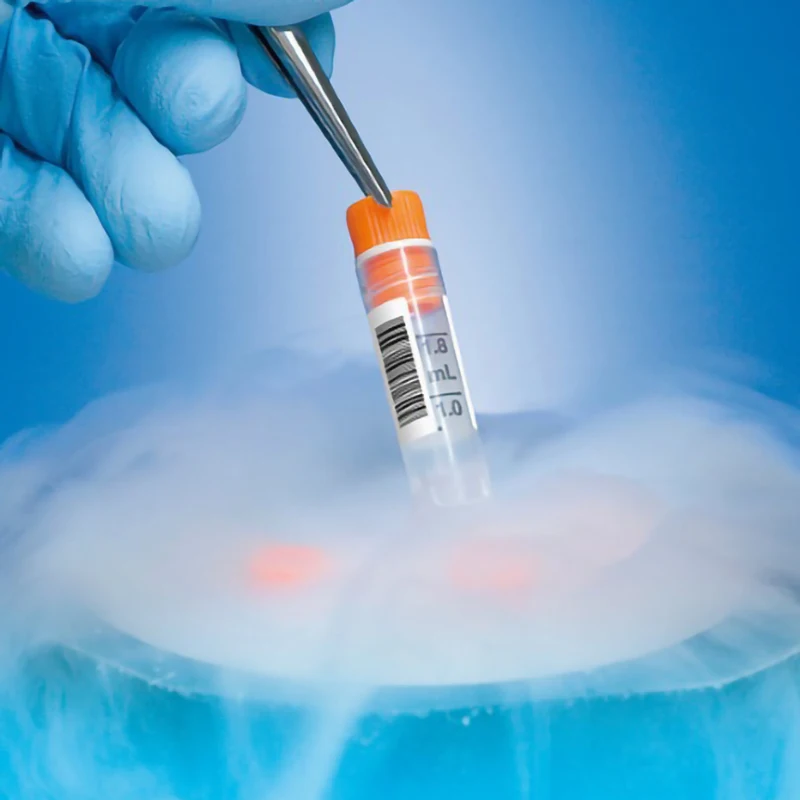 Custom Cryogenic Labels - Durable & Waterproof Stickers