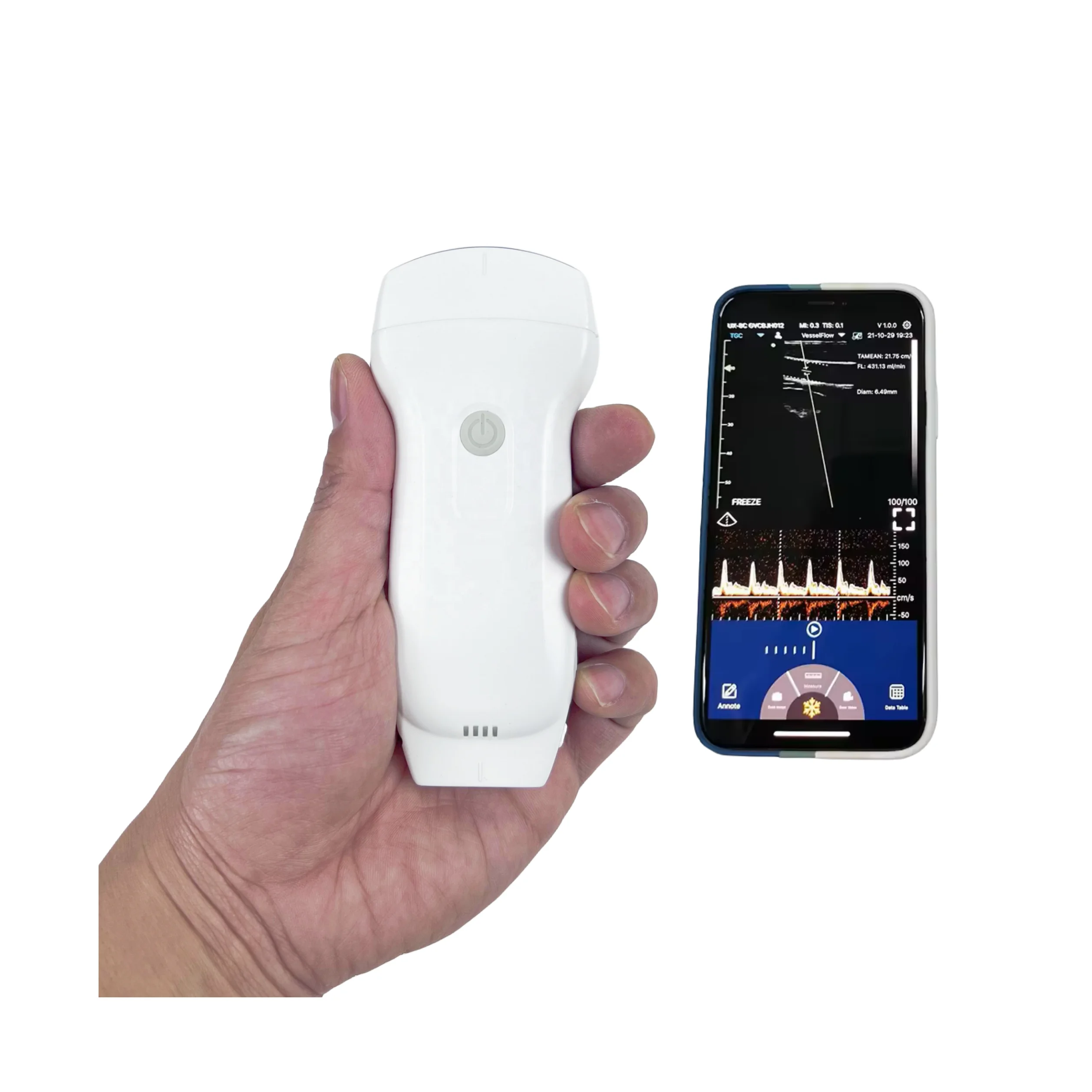 Wireless Ultrasound Handheld Device Wifi And Usb Connection Potable ...