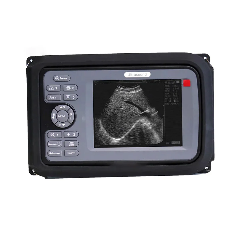 EUR VET Medical Digital Vet Handheld Best Home Ultrasound Scanner ...