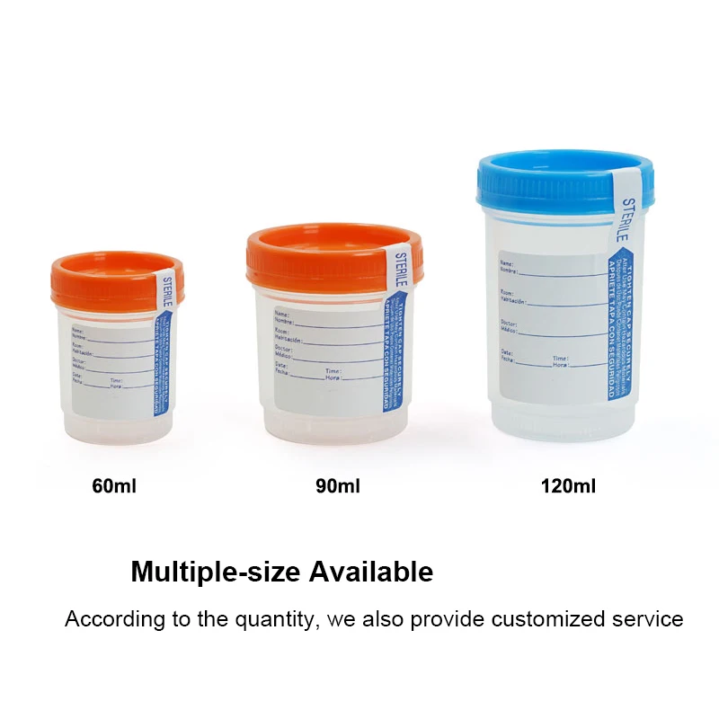 Urine Specimen Container Urine Sample Container Flacon Of Urine - Buy ...