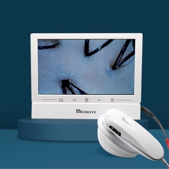 Wireless Scalp Analyzer - Precision Skin & Hair Analysis