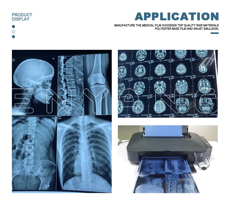 Blue Medical X-ray Film (Inkjet Blue 180) NANYANG 8 inch x 10 inch 100 ...