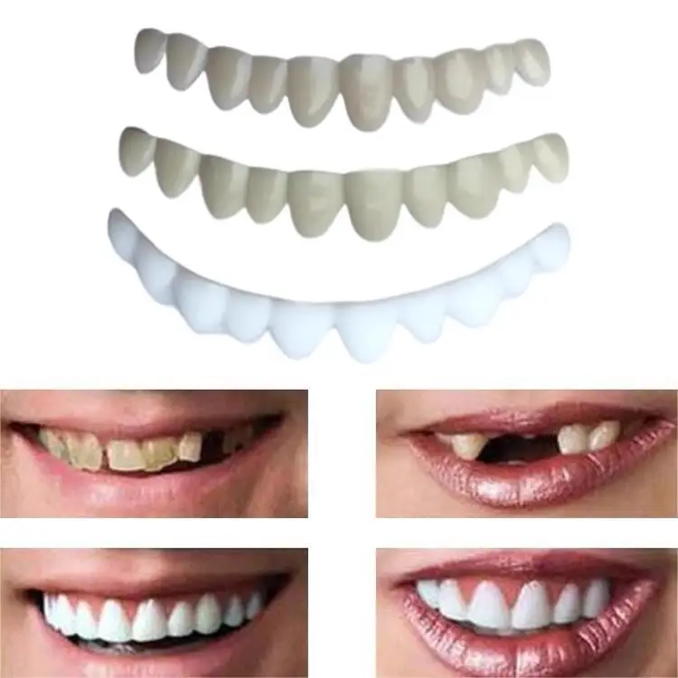 Moldable False Teeth - Instant Smile Veneers Denture Sticker Braces Denture