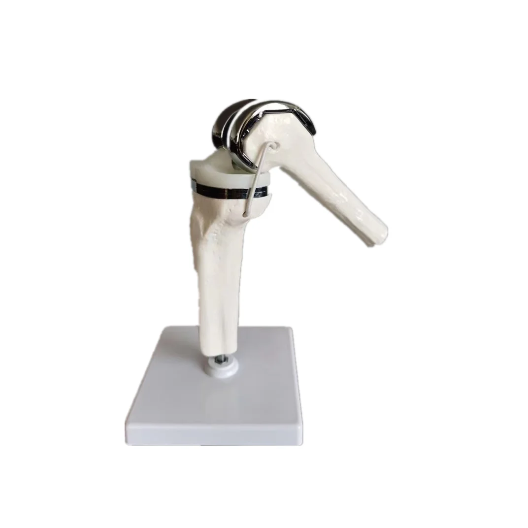 Medical Science Human Knee Joint Model Human Bone Model Artificial knee ...