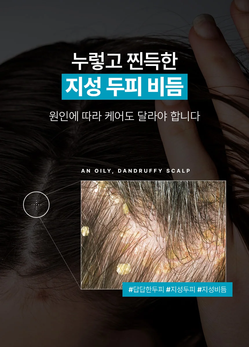 Cera Cool Calming 500ml Gel Shampoo Made in Korea for Dandruff and Oily ...