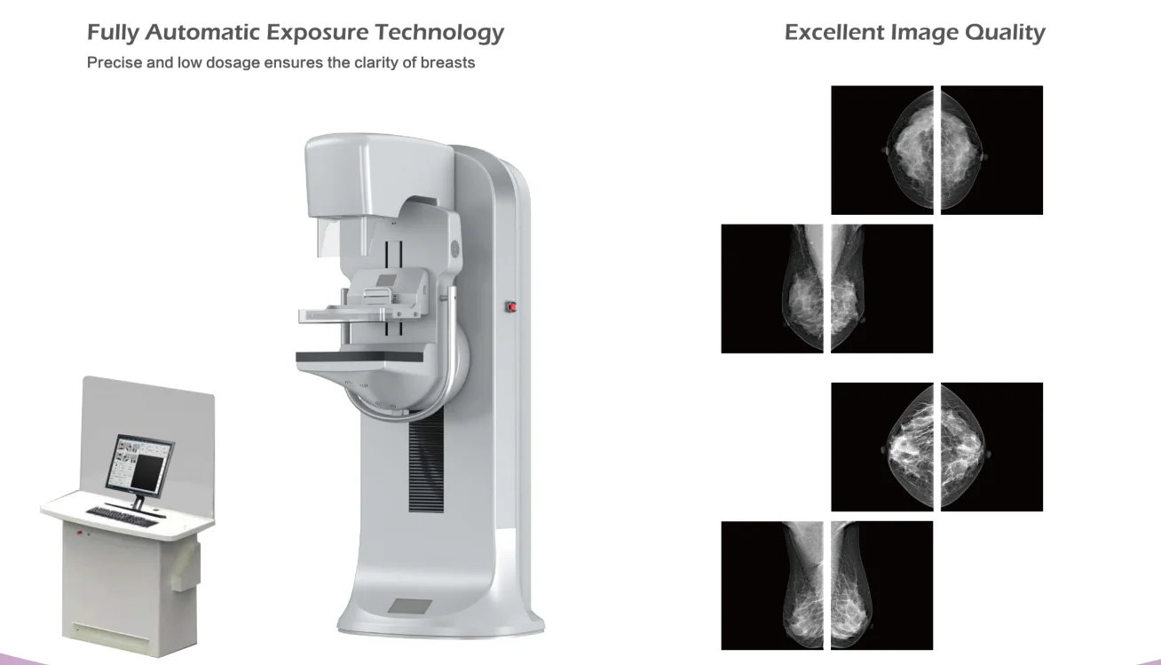 Breast Machine Digital Mammography - MSLRX08 System