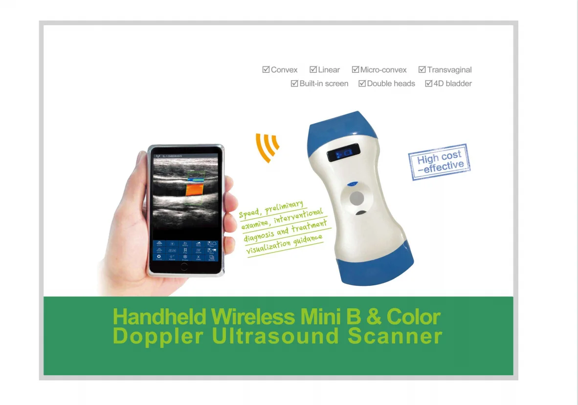 Double Probes Wireless Color Doppler Ultrasound Scanner
