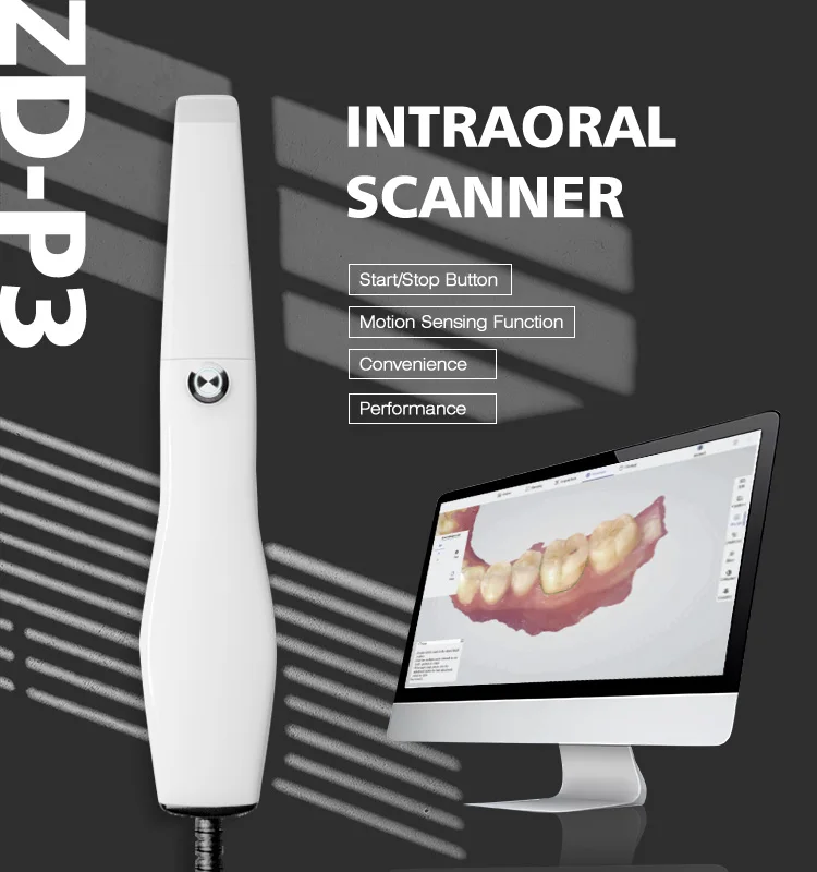 Dental Equipment Portable 3d Intrao Oral Scanner For Dental Clinic ...