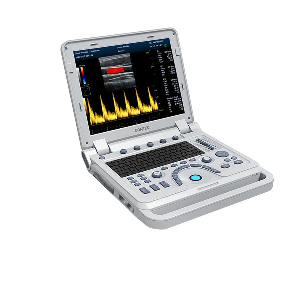 Contec Cms1700b Abdominal Obstetric Urology Cardiac Pediatric ...
