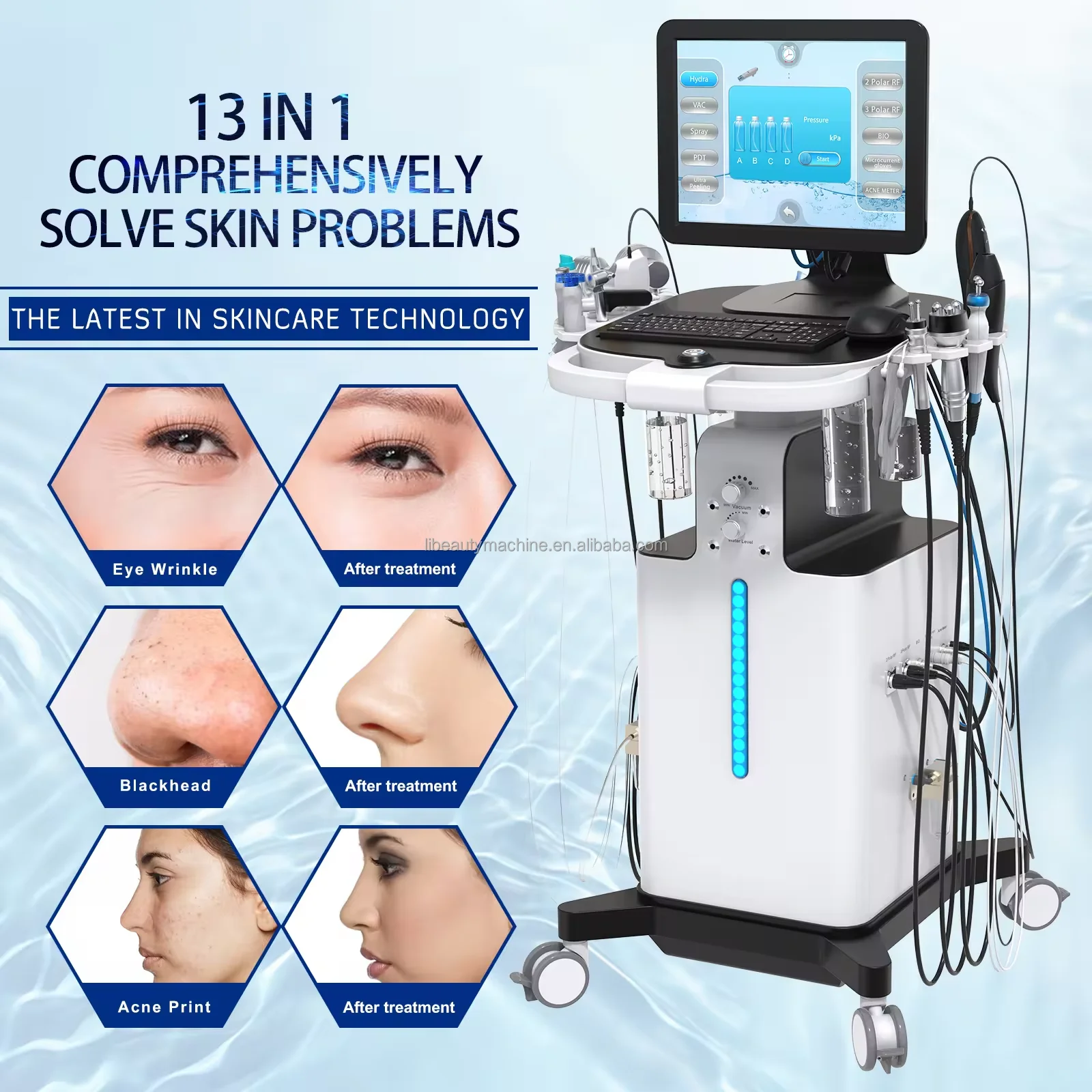 Newest Korean Professional Skin Analyzer Facial Hydro Hydra ...