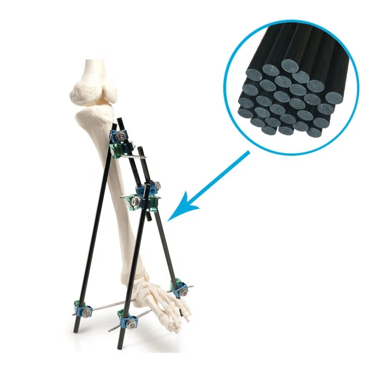 Carbon Fiber External Fixator Rods - High Strength & Light Weight