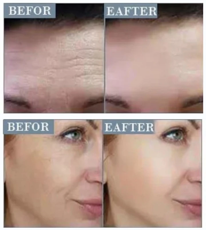 Magic Thread Anti-Aging - Lift and Tighten Needleless