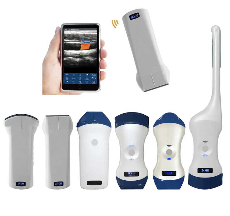 Super Clear Image 3 in 1 Wireless Ultrasound Probe by Yubai