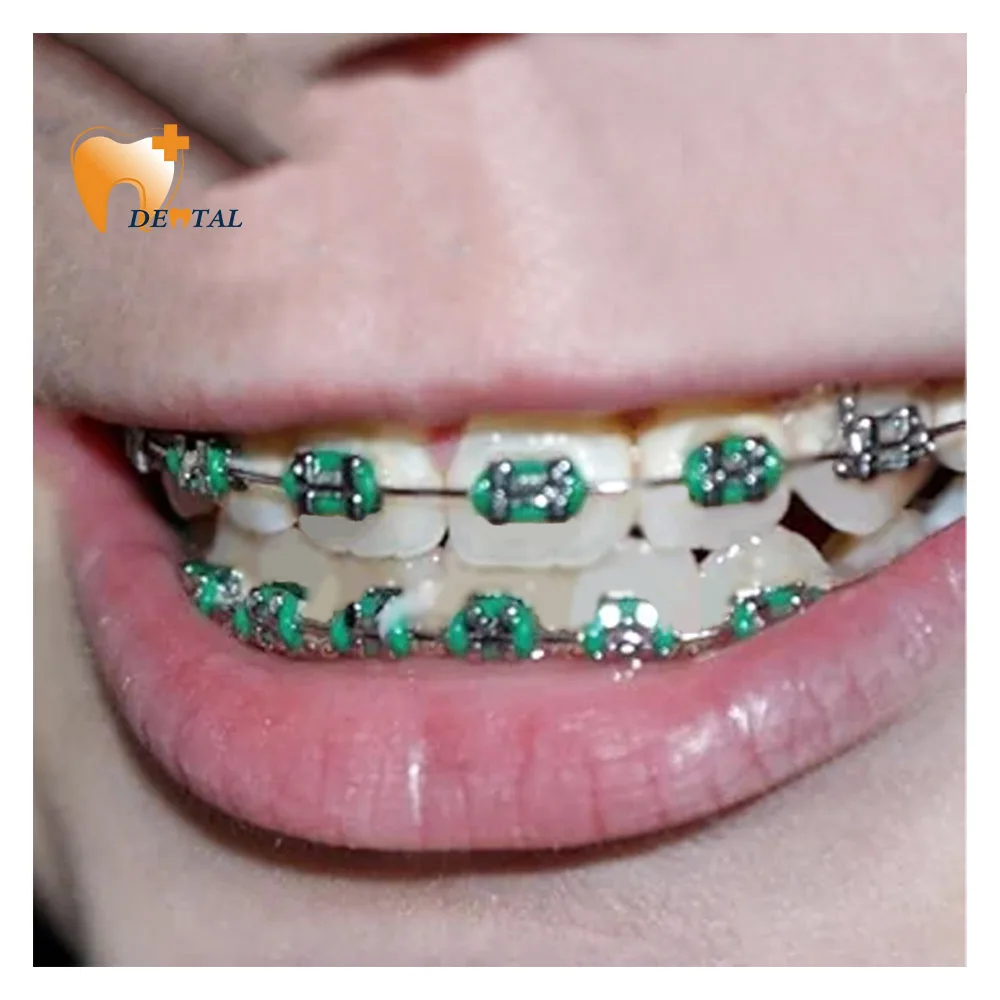 Orthodontic materials Color Complete braces Fashion braces bracket arch ...