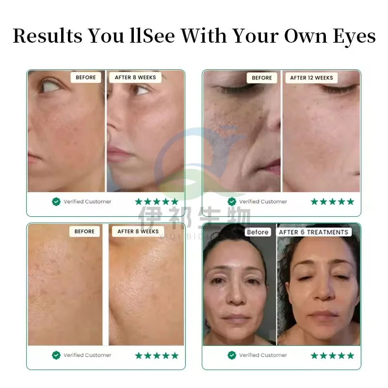 Professional Micro Needling Ampoules Microinfusion System Dermalheal ...