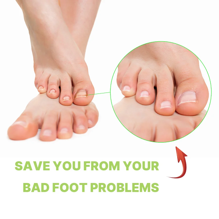 Anti Fungal Foot Repair Dead Skin Removal Peeling Moisturizing ...