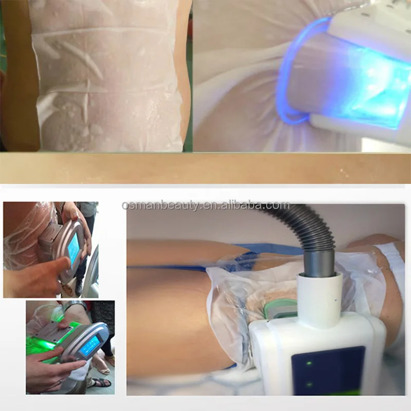 Wholesale Cryolipolysys Crio Lipolysis Antifreeze Coolant Membrane Pad ...