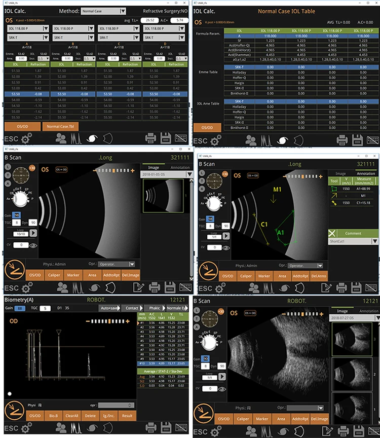 Ophthalmic Diagnostic Equipment - Retiwave1000 AB Scan Ultrasound