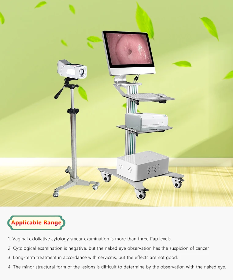 Digital Vaginal Colposcopy Machine Video Colposcope Camera - Buy Video ...