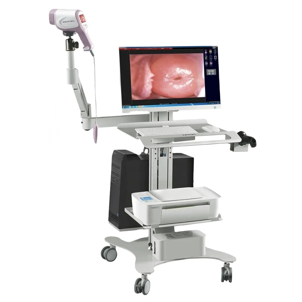 Gynecological Colposcope Kernel KN-2200I - Digital Imaging