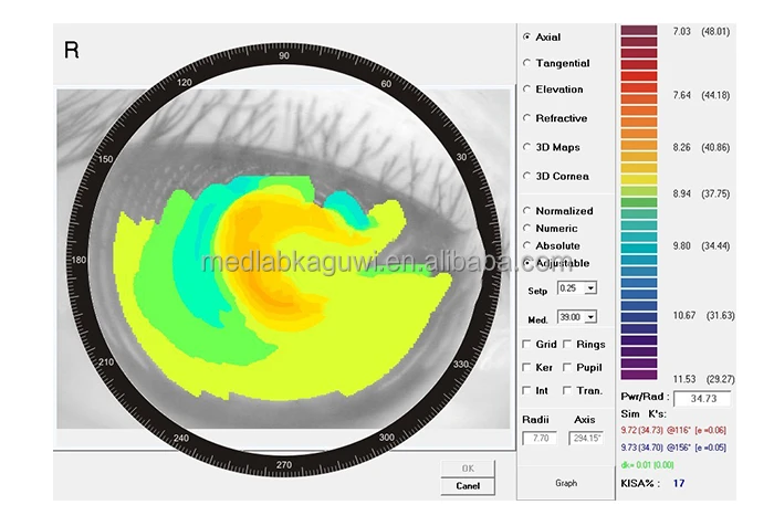 Corneal Analysis Map The Surface Curvature Of The Cornea Lab Eye ...