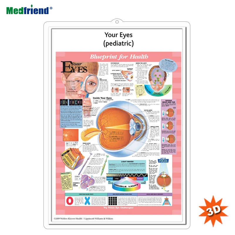 3D Medical Human Anatomical Wall Chart / Poster - AMD Progression and ...