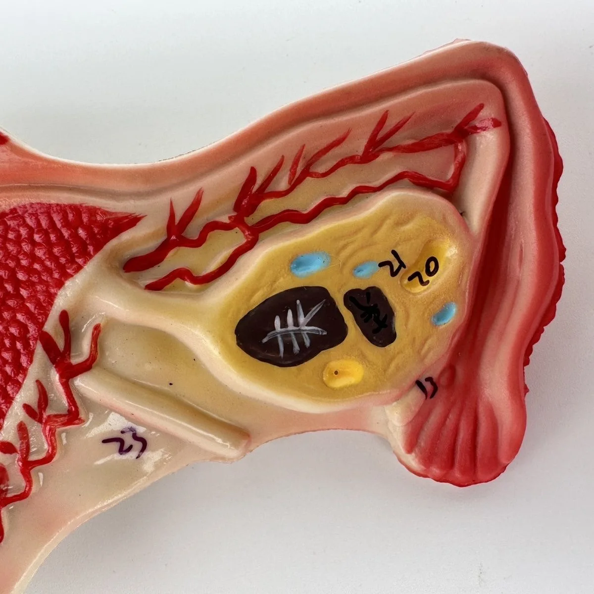 Kyrenmed Female Uterine Ovarian Model - Life Size Gynecology Teaching Tool