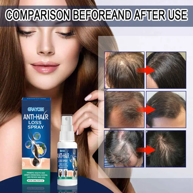 Wholesale Herbal Formula Moisturizing Hair Follicle Nutrition Liquid