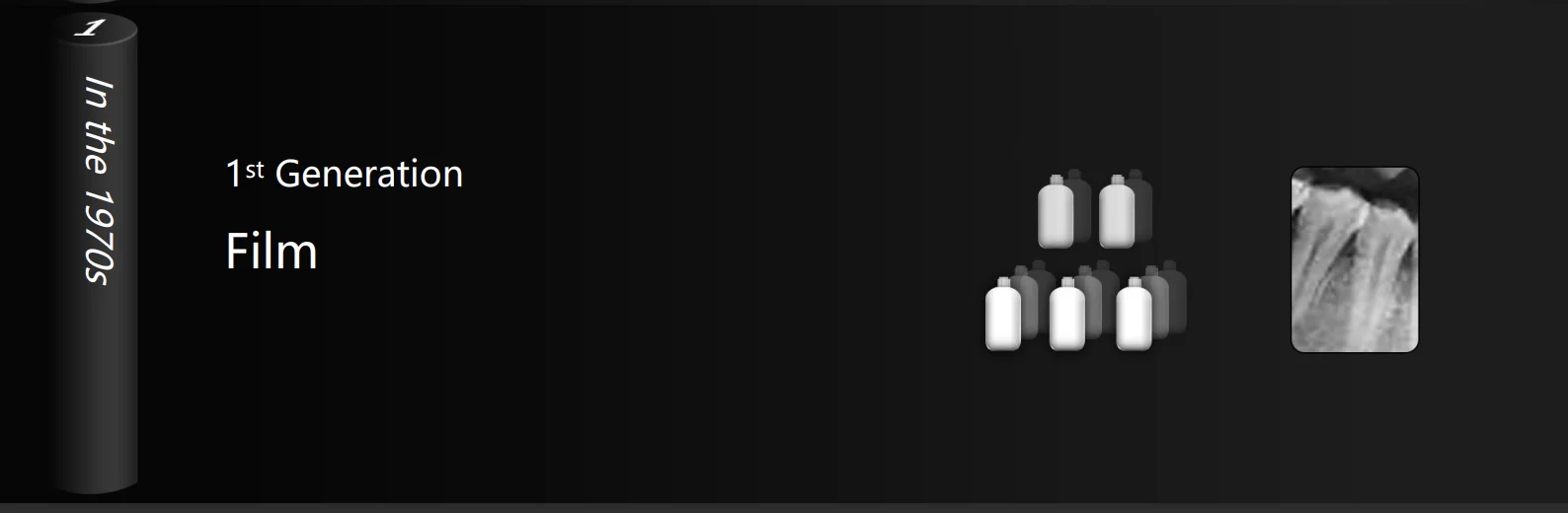 Rvg Digital Oral X-ray Sensor Oral Imaging System Dental X-ray Sensor ...