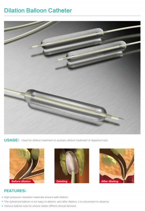 Balloon Dilation Catheters - Various Sizes for Gastrointestinal Expansion