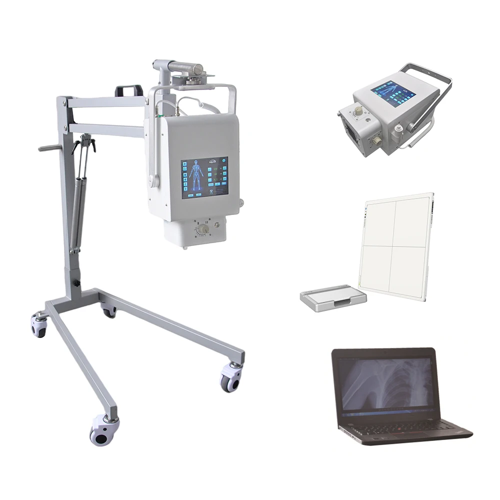 8KW Digital Portable Medical Xray Radiology Machine Mobile Digital ...