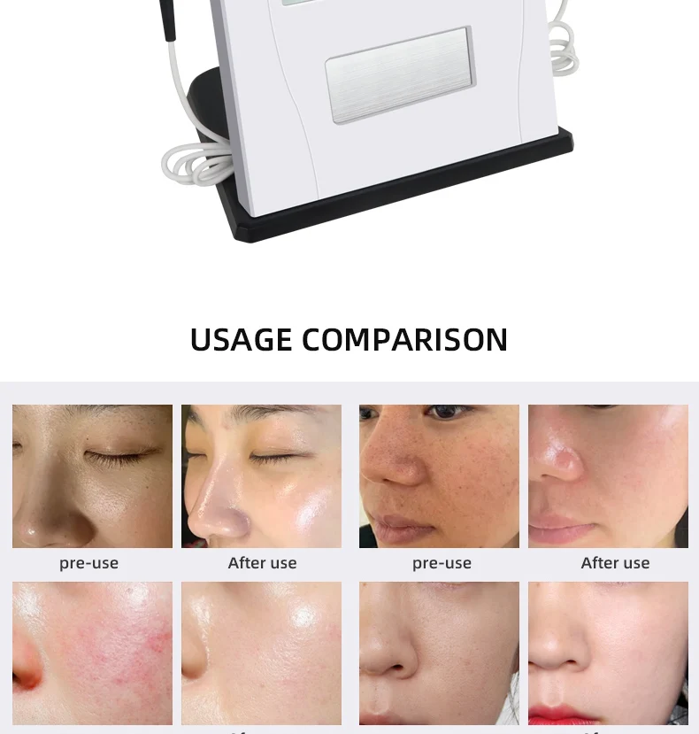 3 In 1 Facial Machine Whitening Facial Kit Co2 Bubble Facial ...