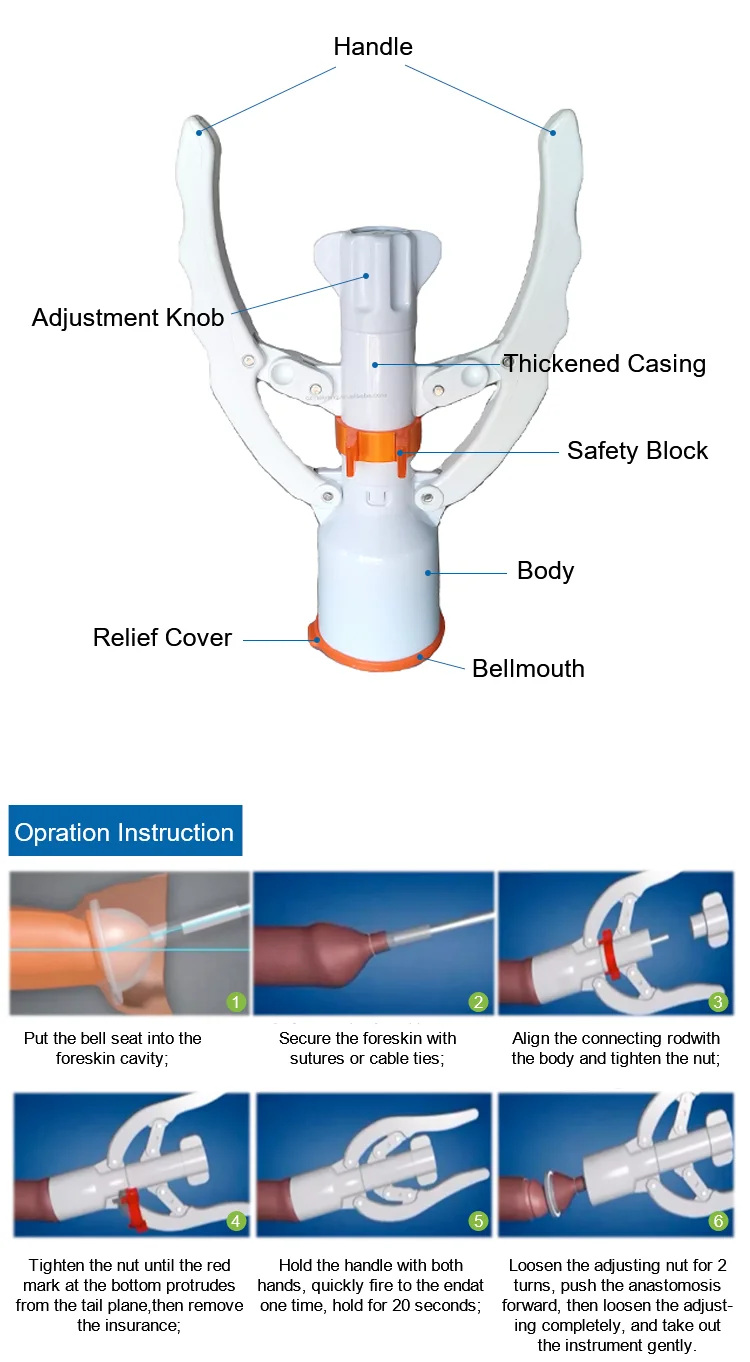 Disposable Medical Foreskin Cut Circumcision Stapler - Buy Disposable ...