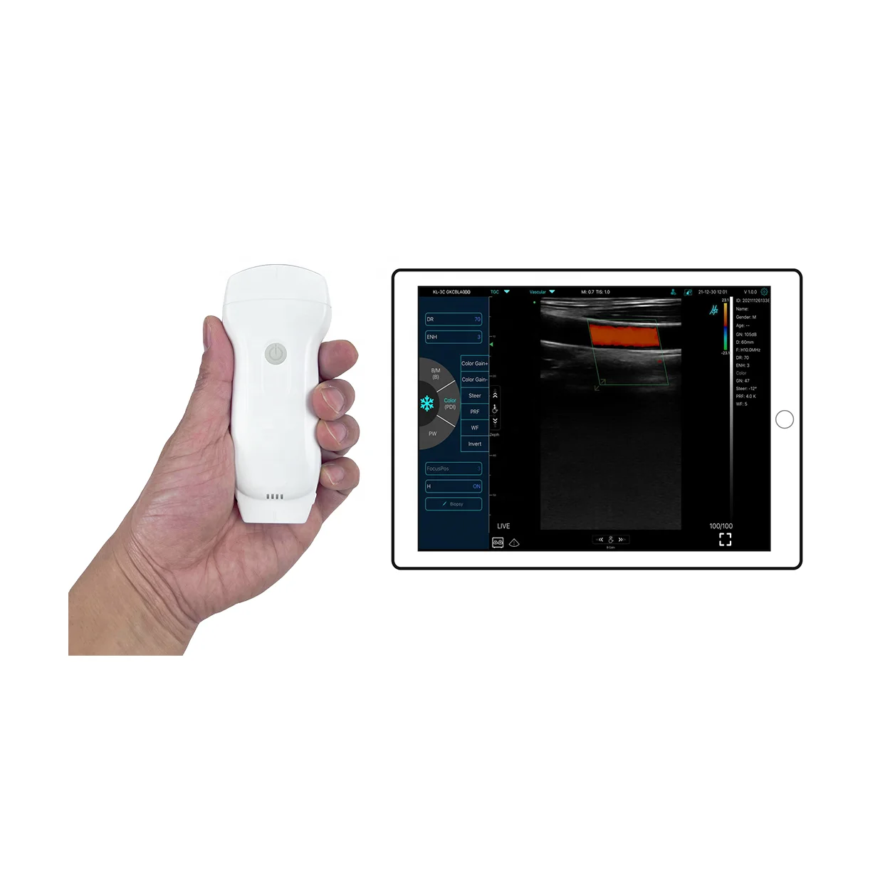Small Size Handheld Doppler Ultrasound Scanner Machine Ultrasonido ...