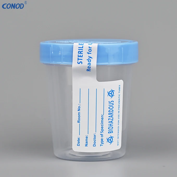 Sterile Urine Containers / Analysis Cup Medical Specimen Container ...
