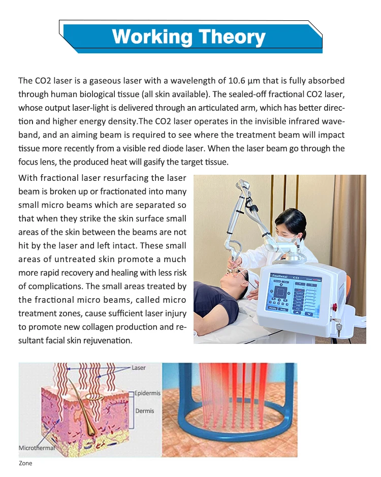 Fractional CO2 Laser Machine 4D Mini Portable Skin Stretch Marks ...