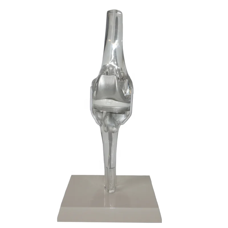 Transparent Knee Joint Replacement Model - Buy Knee Joint Replacement ...