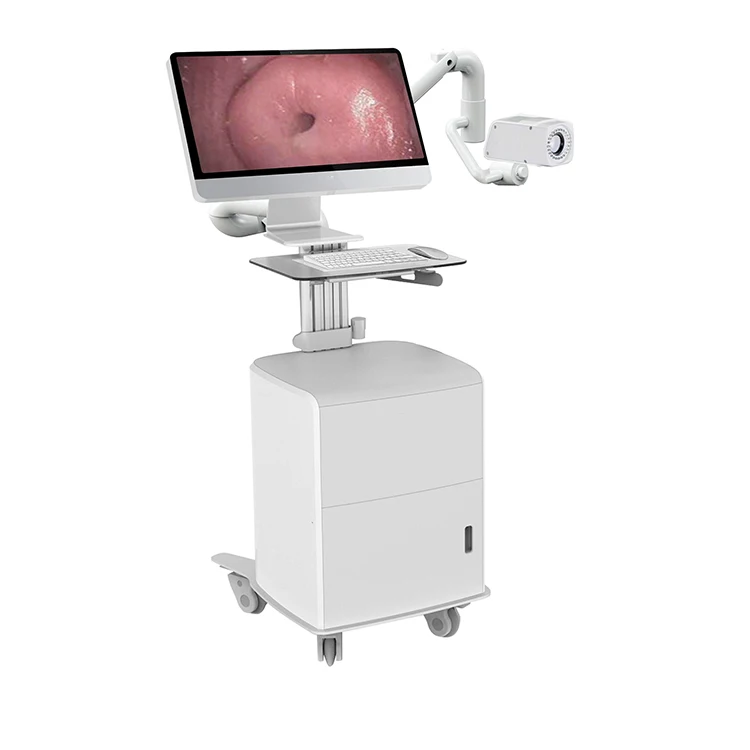 Medical Hospital Digital Electronic Colposcope HD Camera Vaginal Video ...
