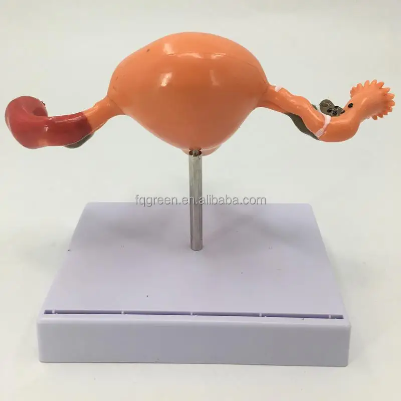 Pathological Uterus Model Medical Female Model For Demonstration - Buy ...