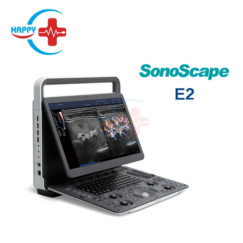 Portable Laptop Sonoscape E2 Ultrasound Machine Color Doppler ...