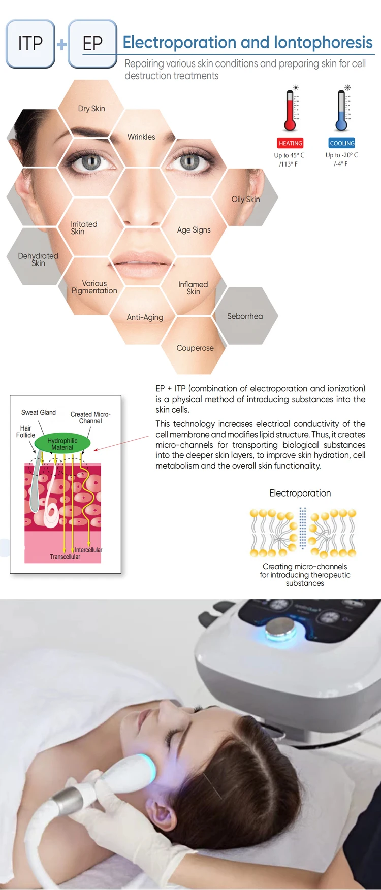 Cryo Facial Electroporation Radio Frequency Rf Machine Itp+ep For Acne ...