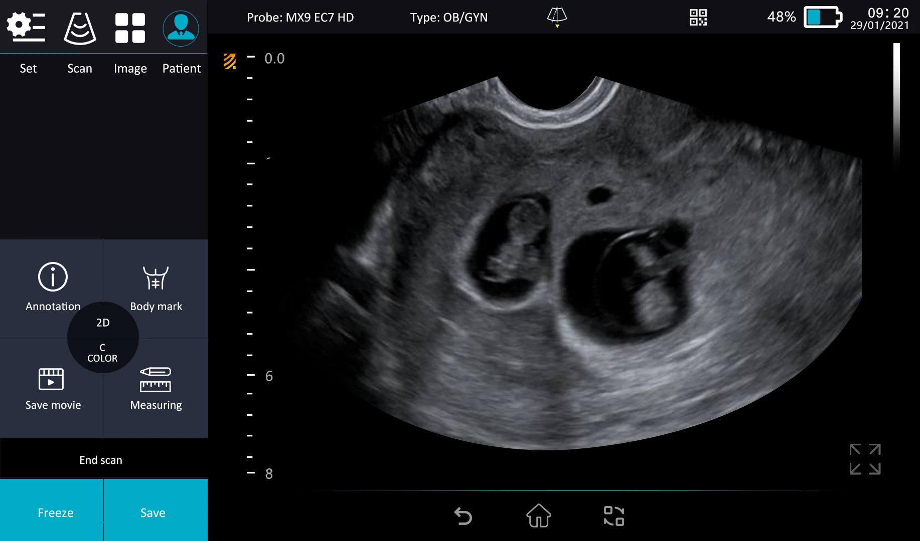USB Ultrasound Medical Scans - Convex Linear Probe BMV MX9